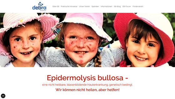 Interessengemeinschaft Epidermolysis Bullosa e.V. DEBRA Deutschland ...